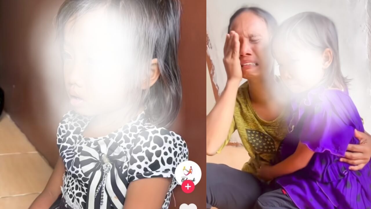 Viral! Kisah Pilu Fatiyah Bocah SD Alami Mata Merah Lebam, Diduga ...