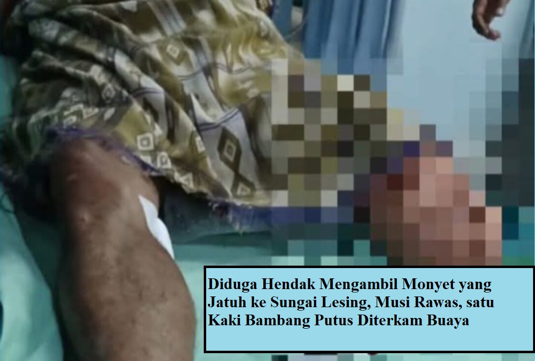 Hendak Ambil Monyet yang Jatuh Ke Sungai, Kaki Pemburu Putus Diterkam Buaya