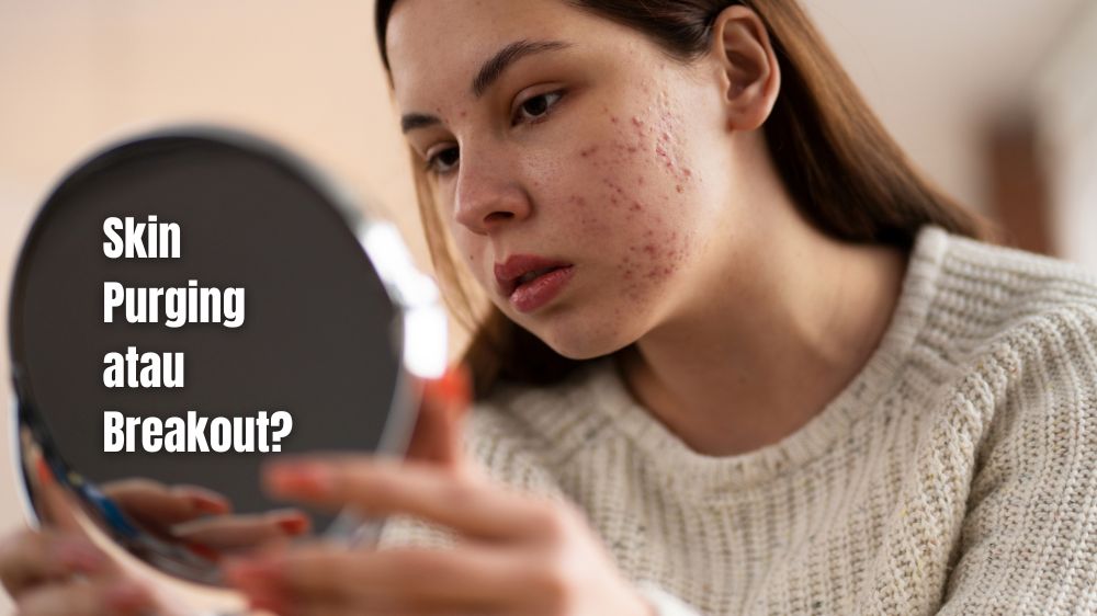 Skin Purging atau Breakout? Ini Cara Bedakan dan Atasi Jerawat Setelah ...